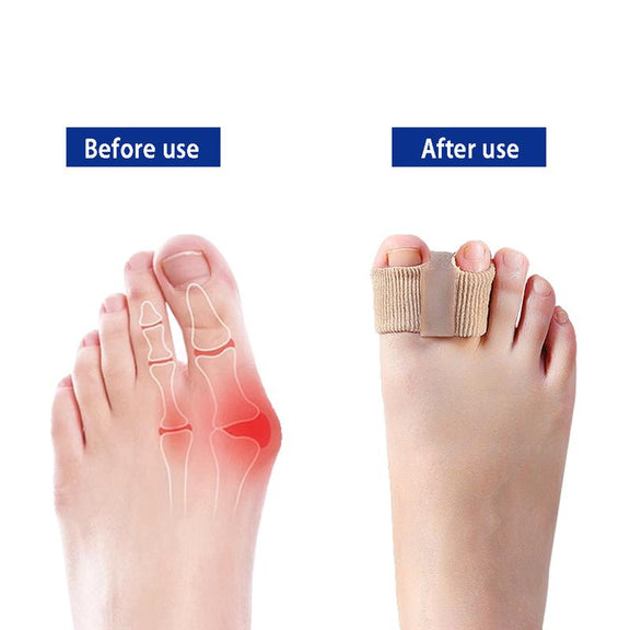 Premium Elastic Toe Separators – Cheerstash